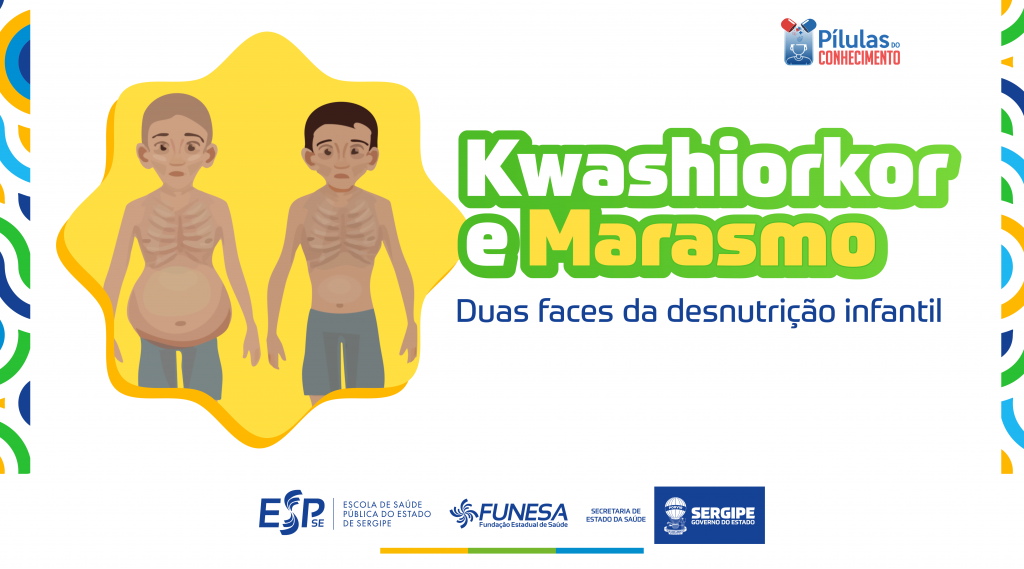 Kwashiorkor e Marasmo: duas faces da desnutrição infantil - Telessaúde ...