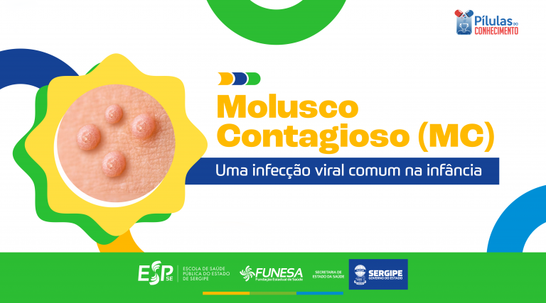 Molusco Contagioso: uma infecção viral comum na infância - Telessaúde ...